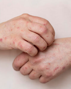 Doctors Dermatology – The Rio Grande Valley Premier Dermatology Center